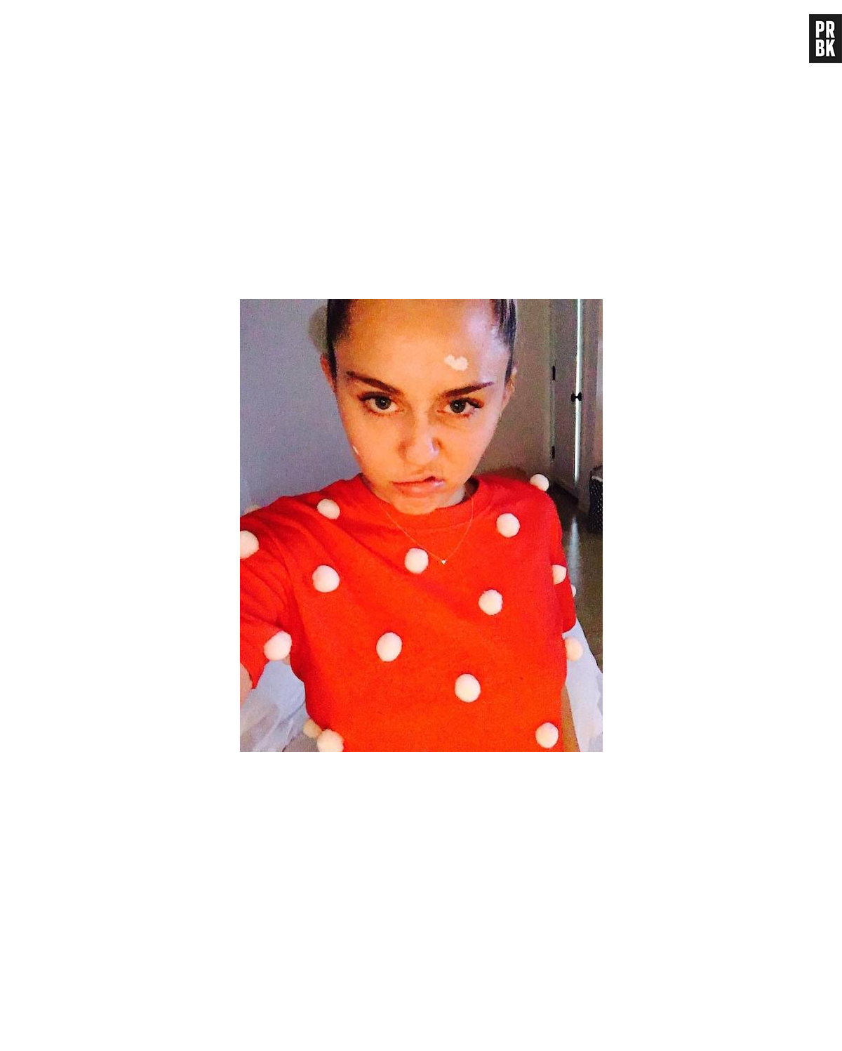 Foto: Miley Cyrus exibe rosto com acne em foto sem filtro - Purebreak