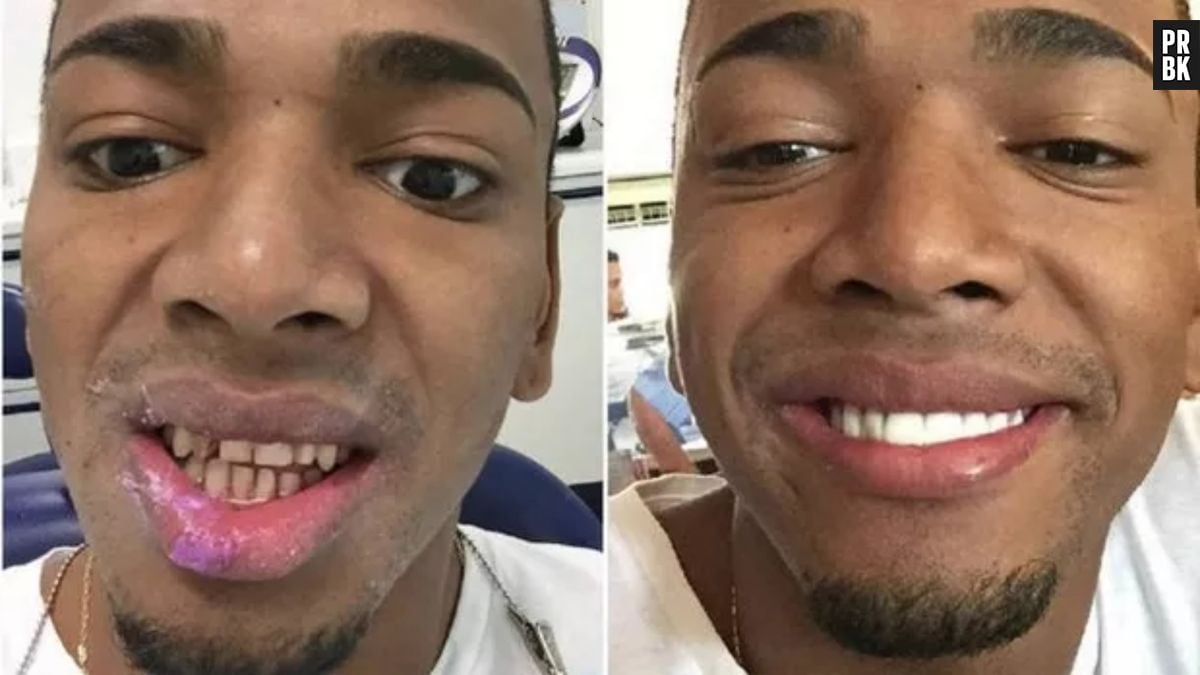 Celebridades Sem Dentes Já Imaginou Como Ficariam Os Famosos Sem